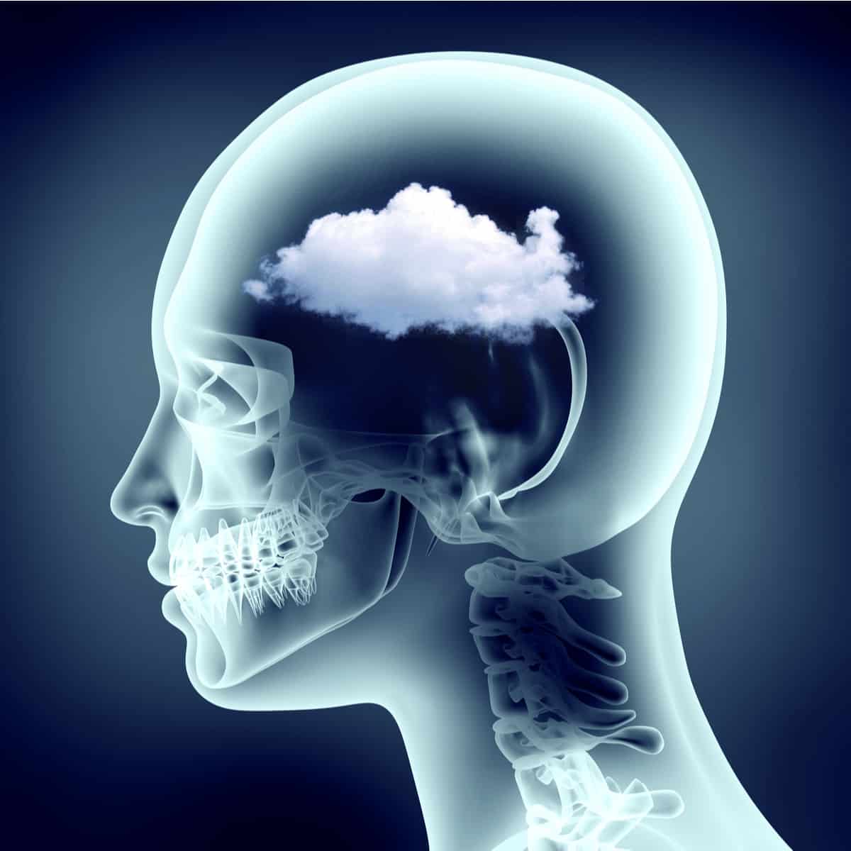Exploring Underlying Causes of “Brain Fog”
