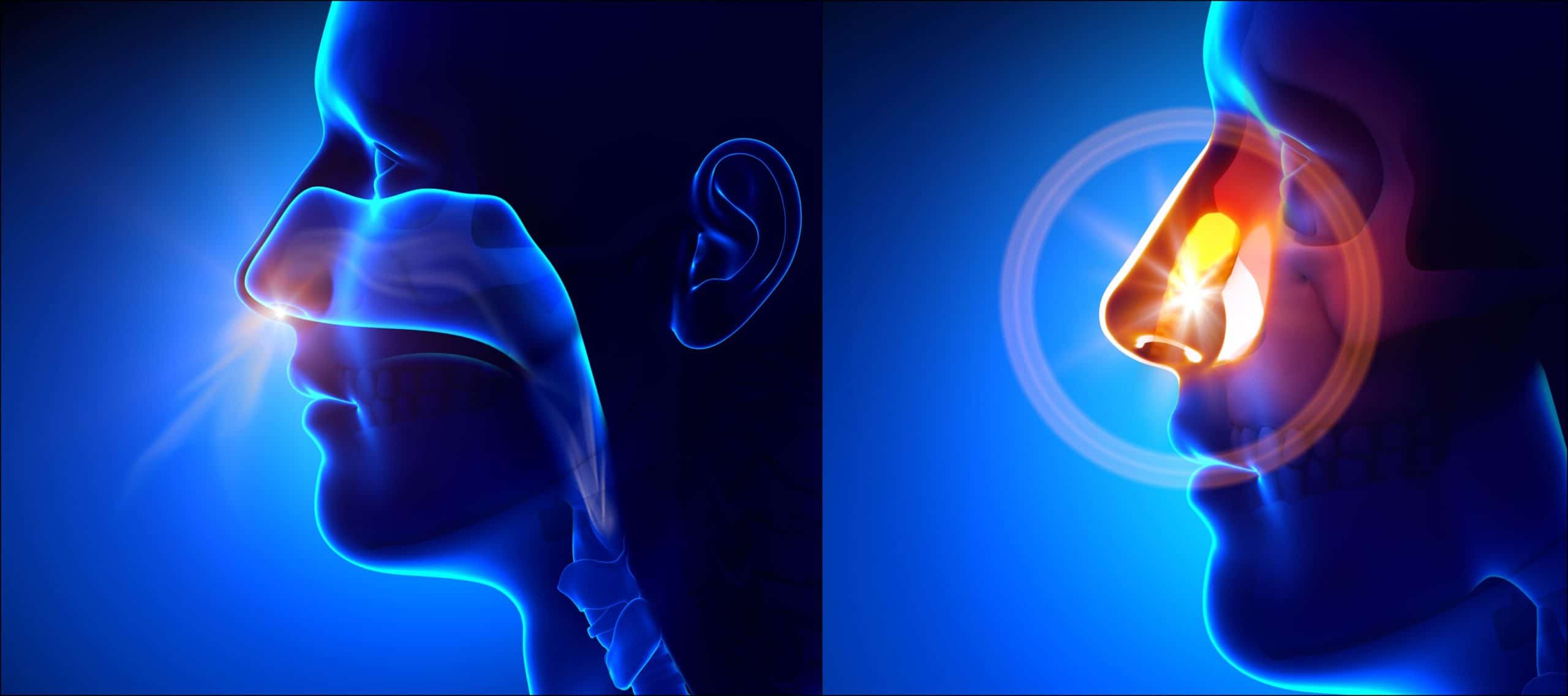 MARCoNS: Key Diagnosis or Moldy Folklore?