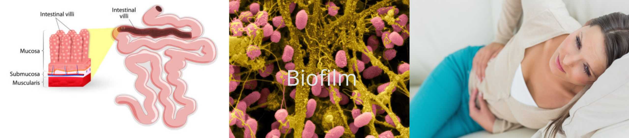 SIBO Part 2: Addressing Biofilm Formation