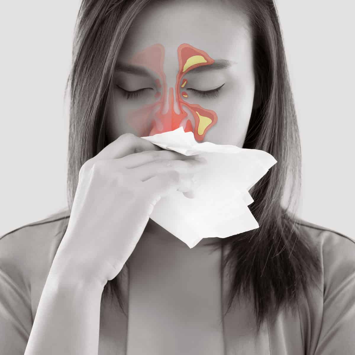 What Are the Causes of a Sinus Infection?
