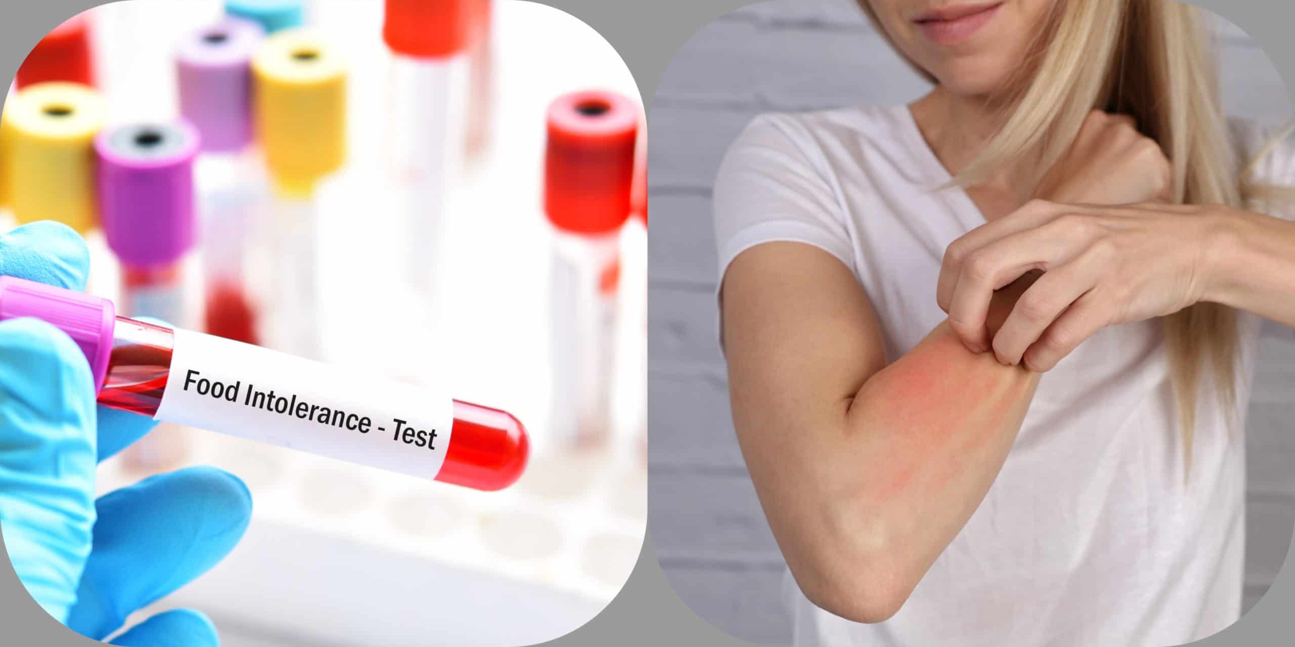 Food Allergy, Sensitivity, and Intolerance and Why it Matters