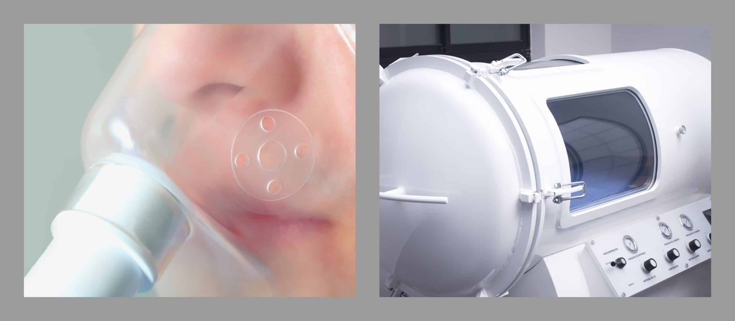 The Power and Benefits of Oxygen Therapy