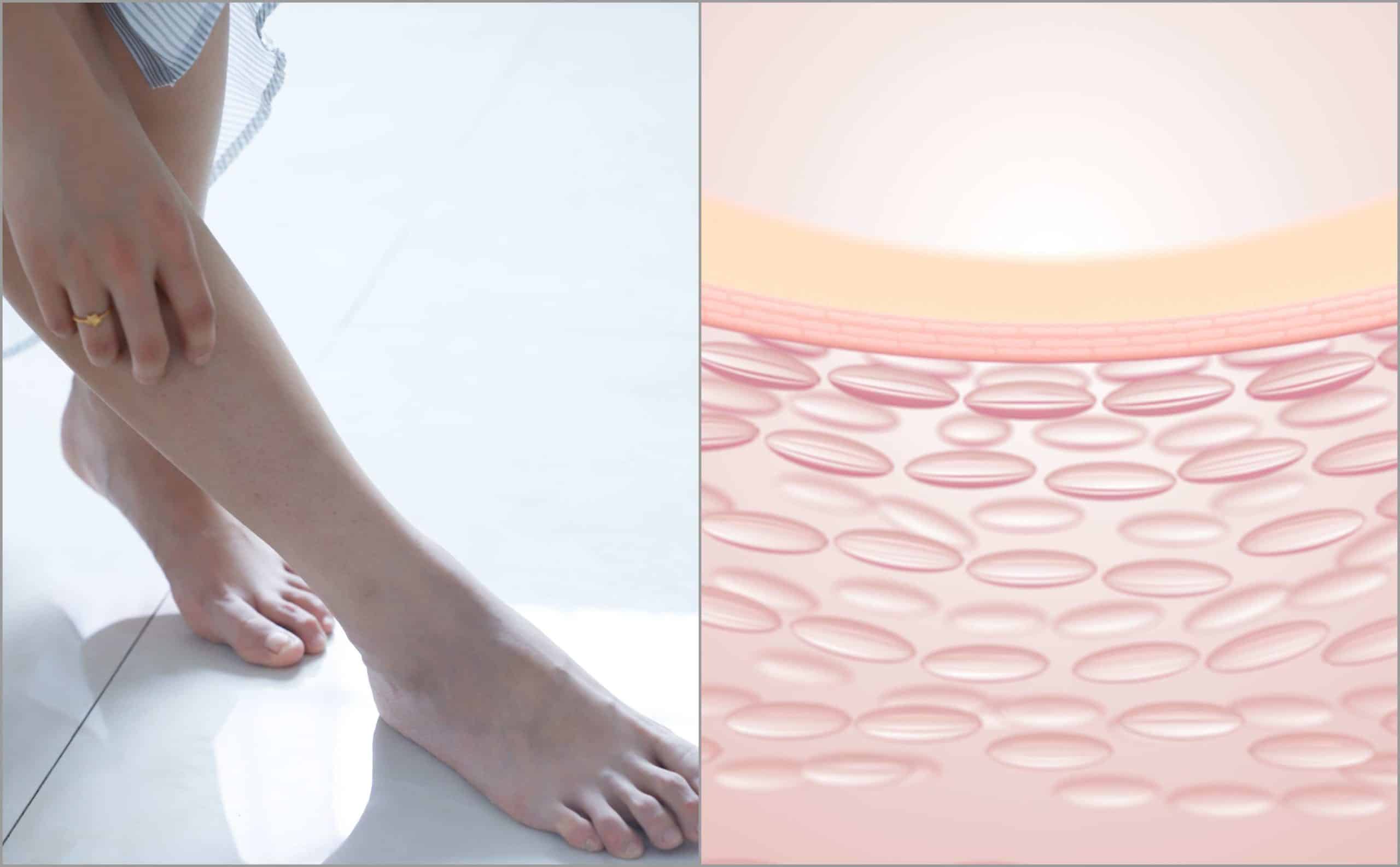 Is Mold Causing Your Skin Problems?